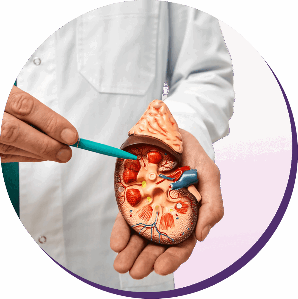 Kidney Stone Care | The CVAC System