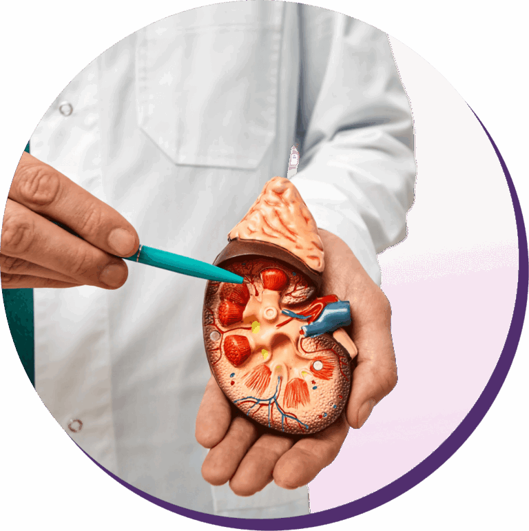 Kidney Stone Care | The CVAC System